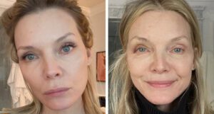10+ Celebrities Who Flaunt Their Natural Beauty Without Makeup or Filters