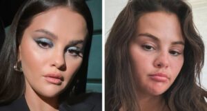 10+ Celebrities Who Flaunt Their Natural Beauty Without Makeup or Filters